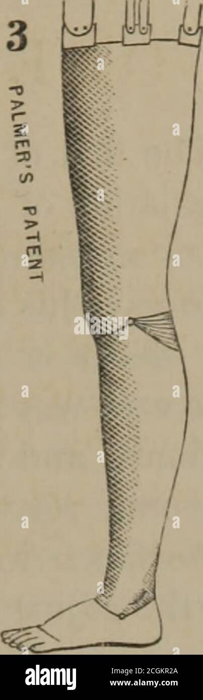. The Palmer arm and leg : adopted for the U.S. Army and Navy by the ...