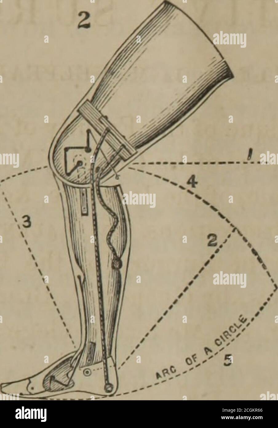. The Palmer arm and leg : adopted for the U.S. Army and Navy by the ...