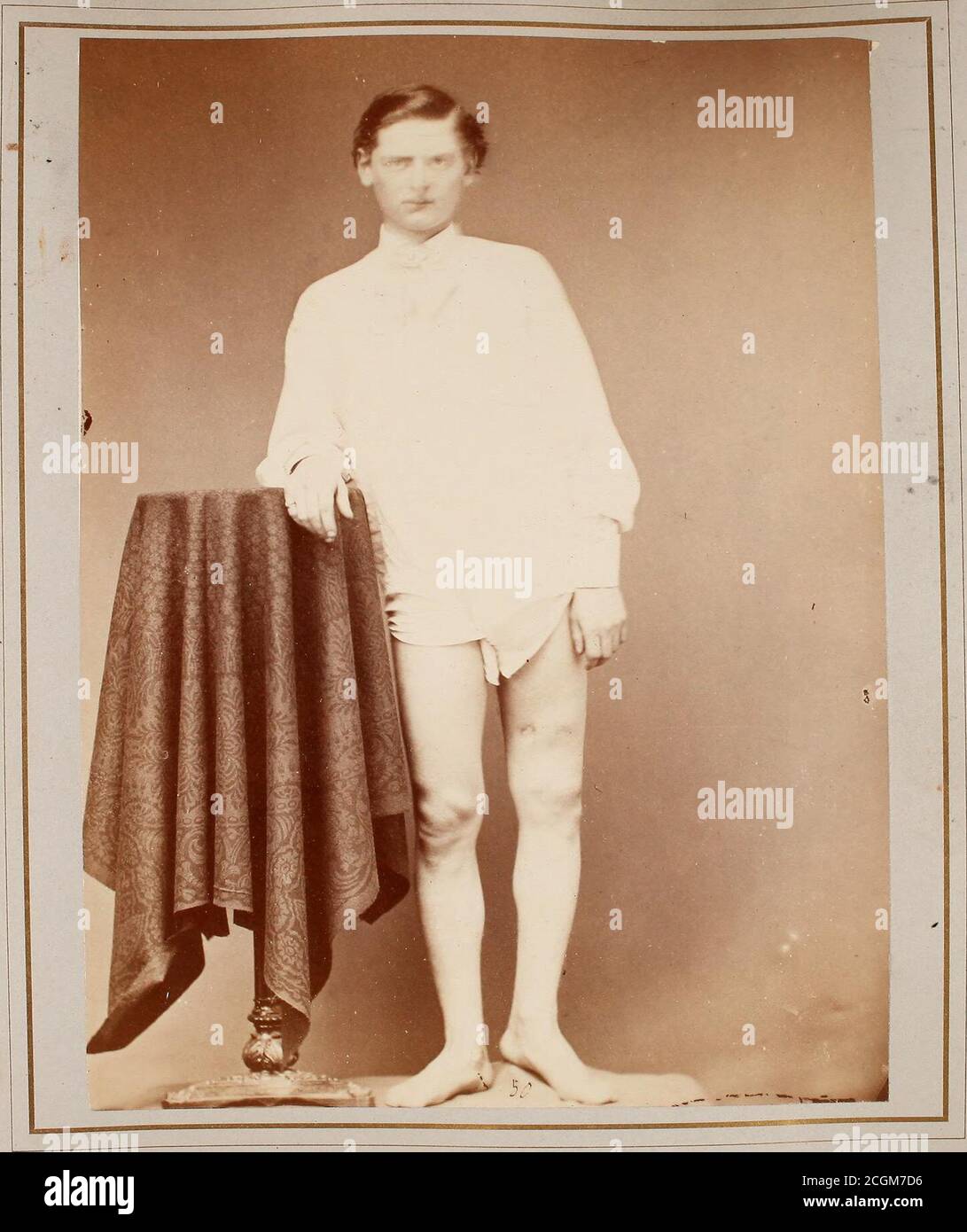 . Photographs of surgical cases and specimens . bles.Lower half of ...