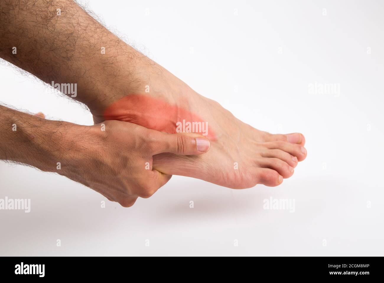 Ankle sprain hi-res stock photography and images - Alamy