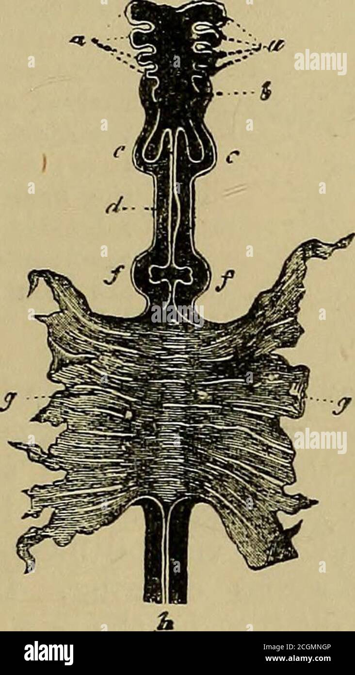 Loop of gut abdomen hi-res stock photography and images - Alamy
