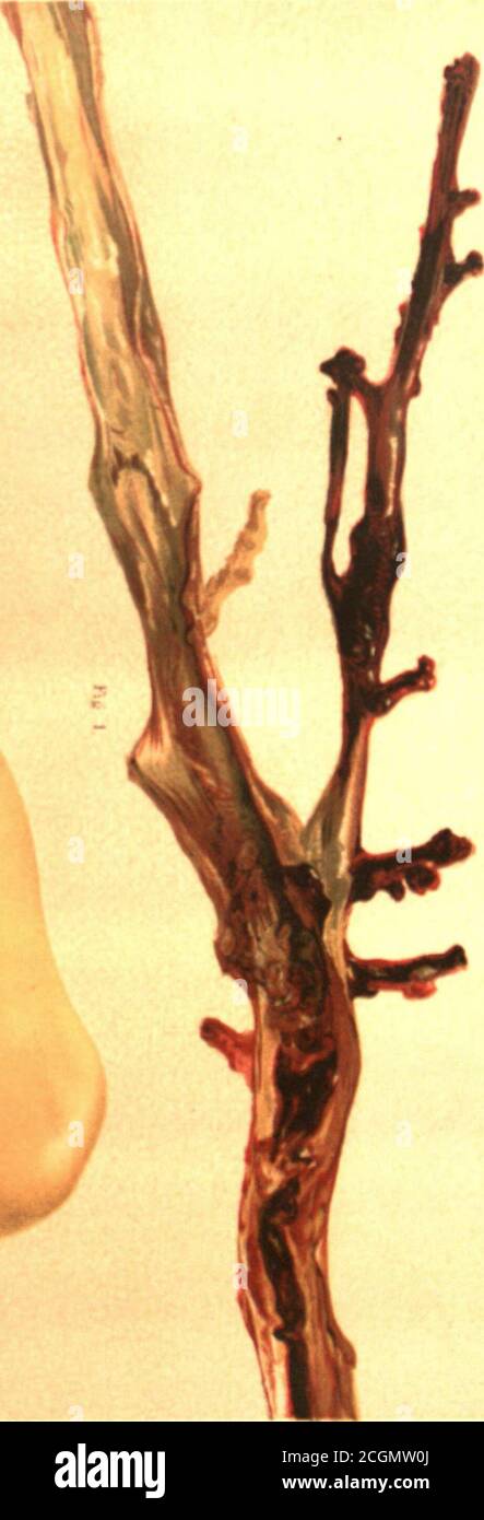 Map of elbow hi-res stock photography and images - Alamy