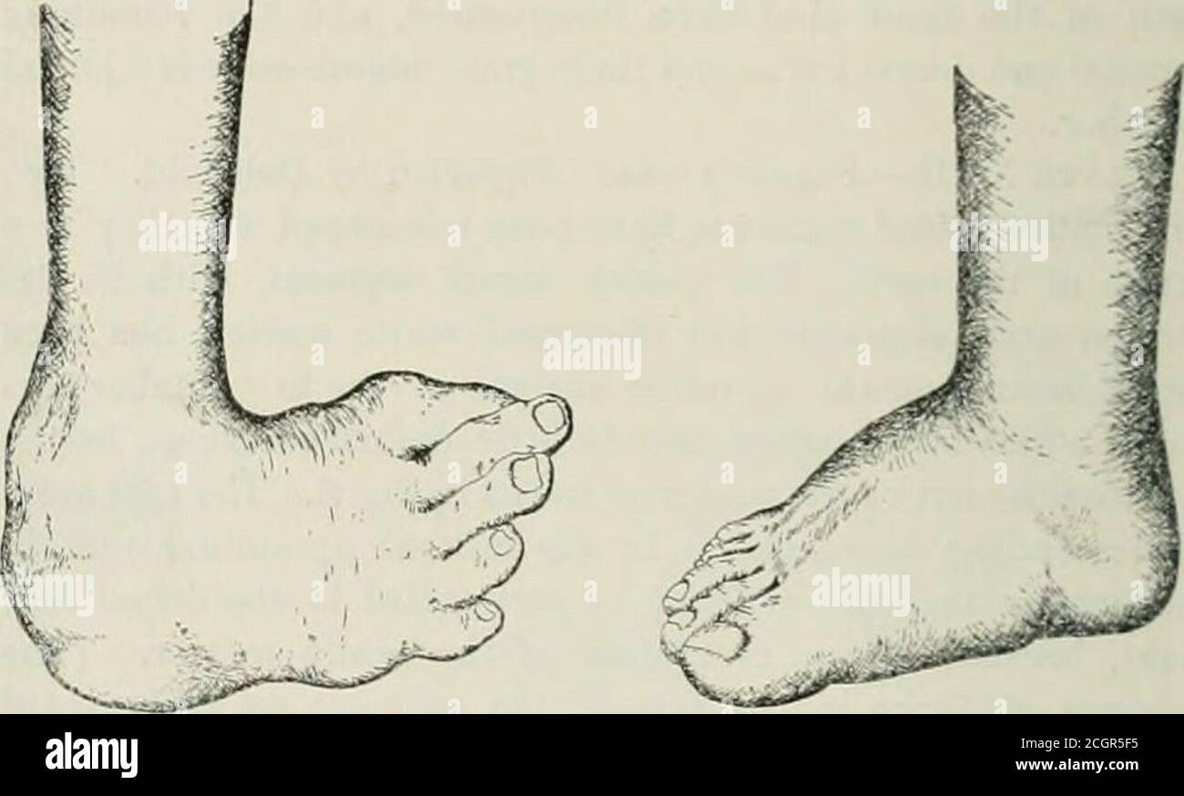 . International record of medicine . rough the two malleoli. The pro ...