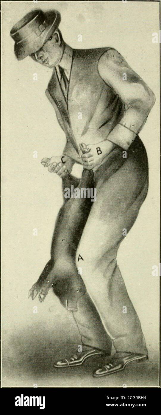 Perineal raphe hi-res stock photography and images - Alamy