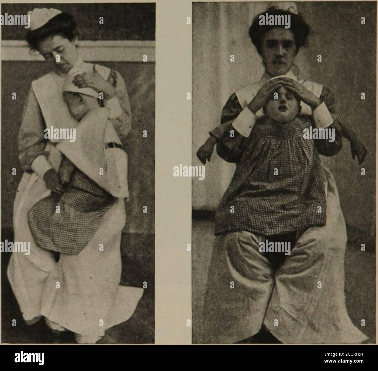 . Nursing in diseases of the eye, ear, nose, and throat . Fig. 4 ...