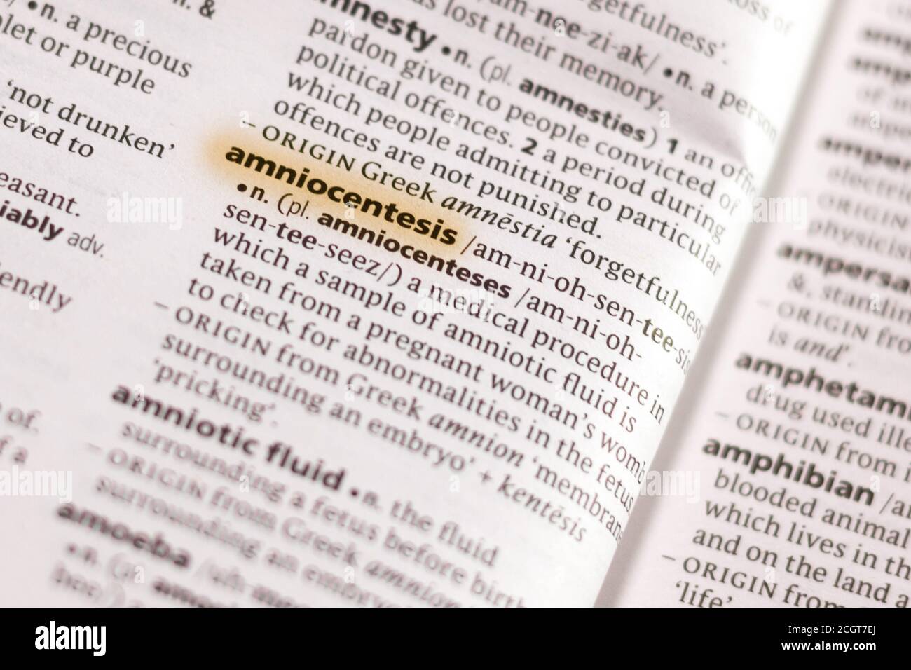 Amniocentesis hi-res stock photography and images - Alamy