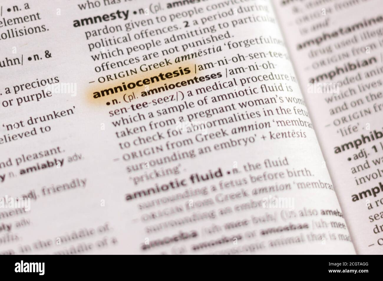 Amniocentesis hi-res stock photography and images - Alamy