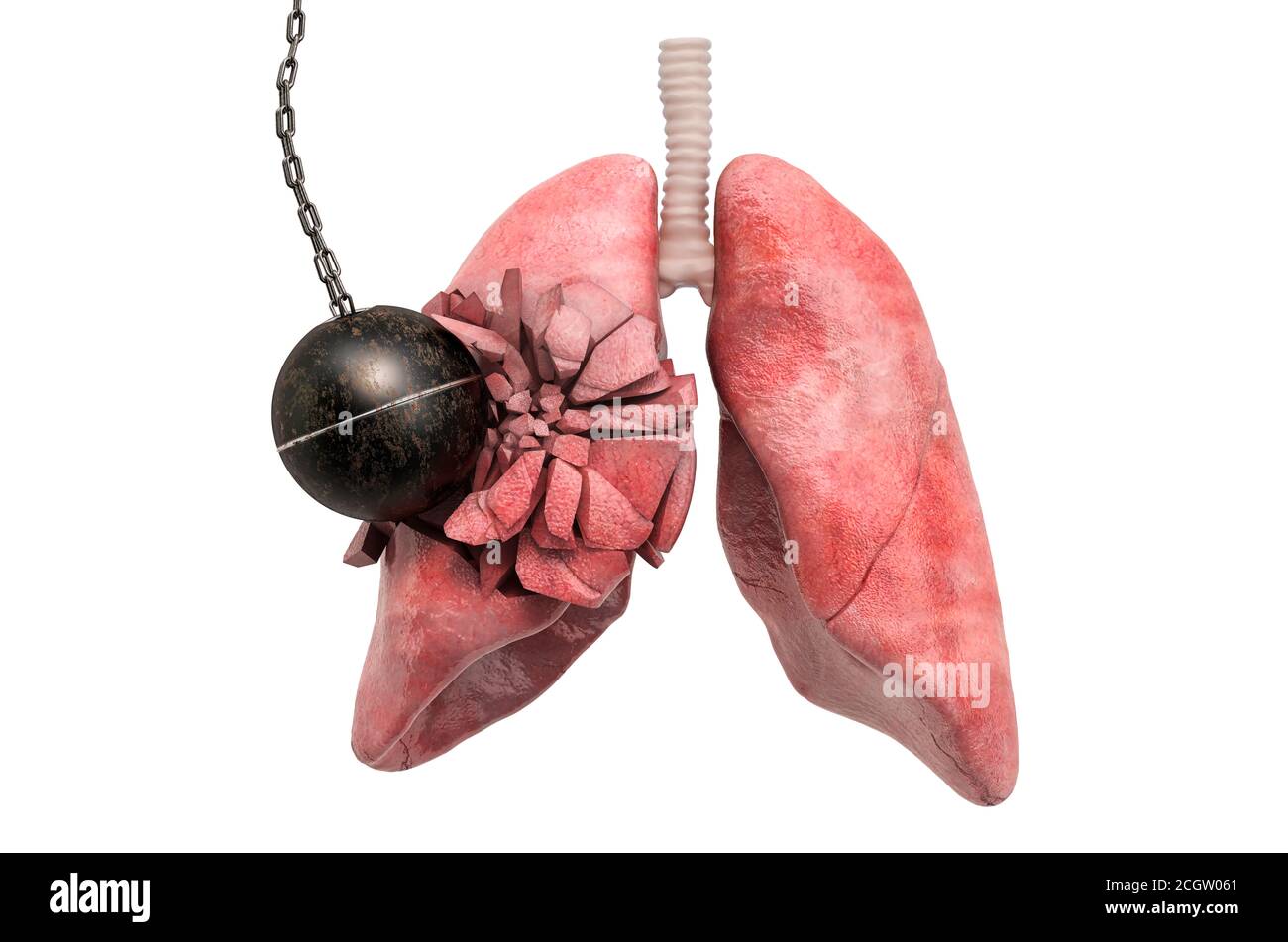 Human lungs destroying by wrecking ball. Pain in lungs, lungs disease ...