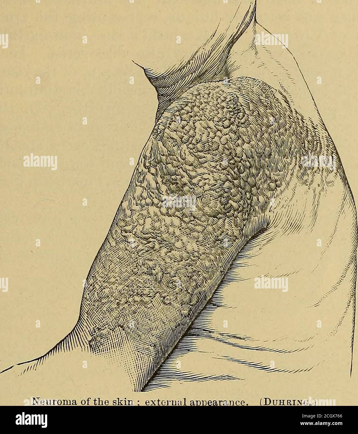 A practical treatise on diseases of the skin, for the use of students ...
