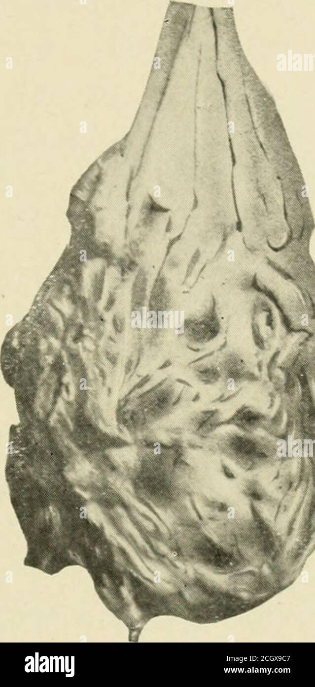 Superficial dissection of hand hi-res stock photography and images - Alamy