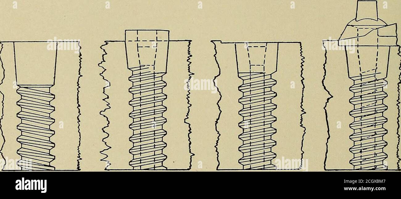 Spike driving machine hi-res stock photography and images - Alamy