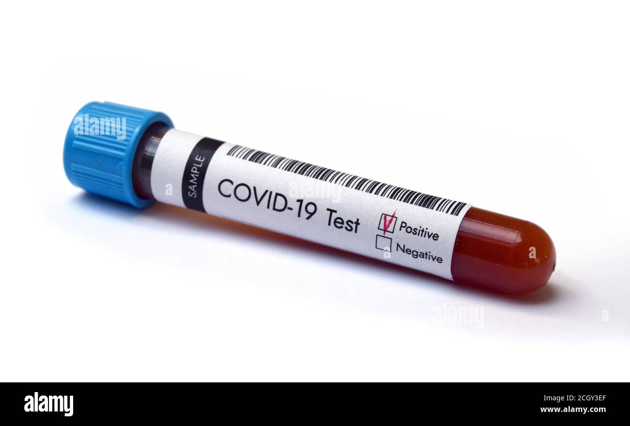 Test-tube with coronavirus test blood sample positive result on white ...