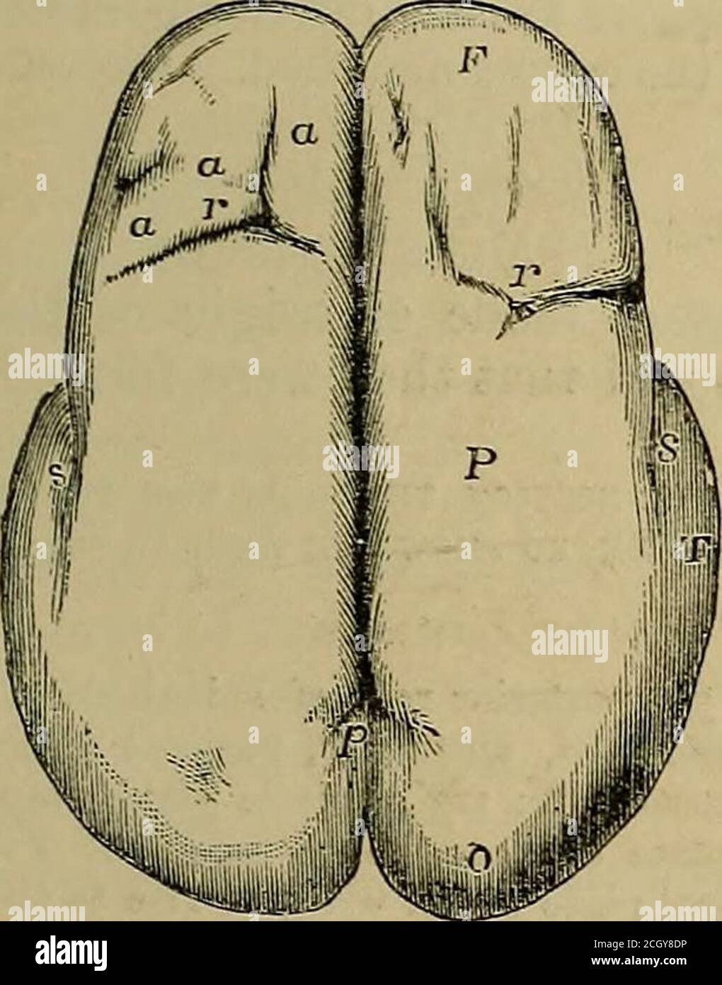 Transverse Fissure