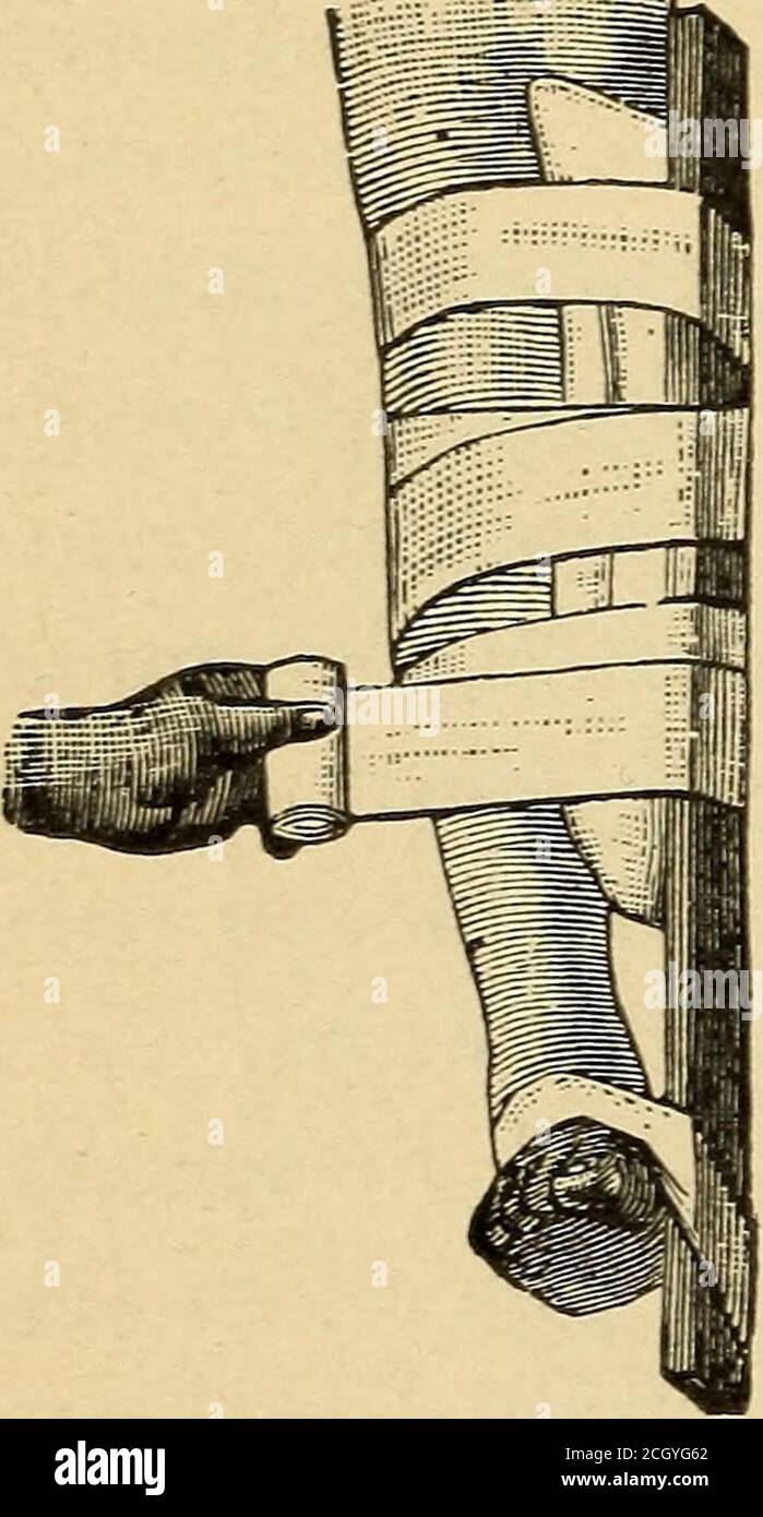 . Atlas and epitome of traumatic . e footwill rest on the ground in the ...