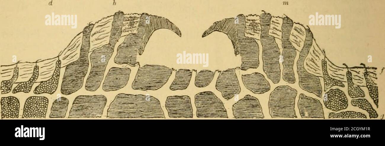 Subcutaneous phlegmon hi-res stock photography and images - Alamy