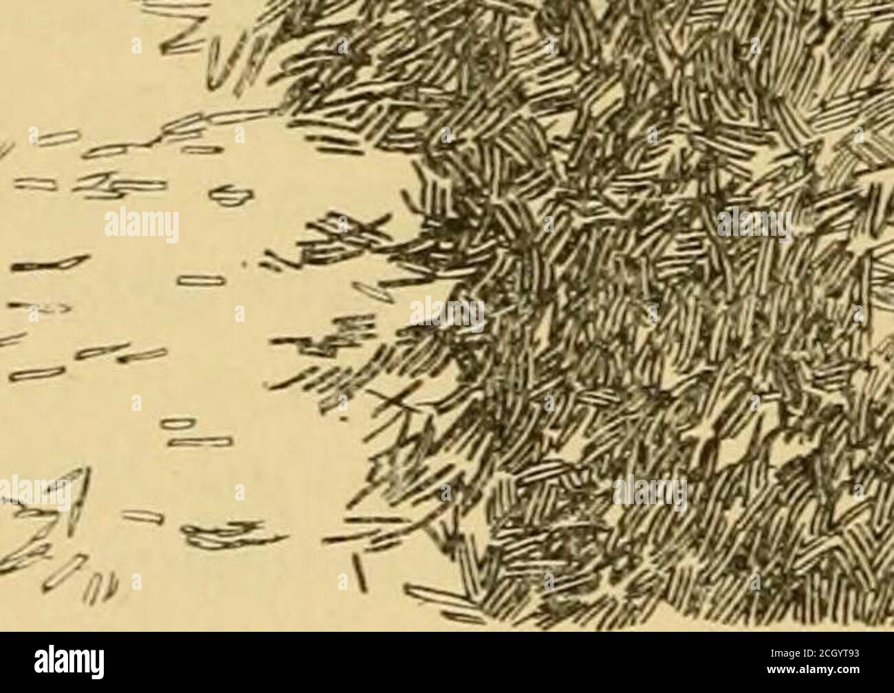 Scarlet fever rash hi-res stock photography and images - Alamy