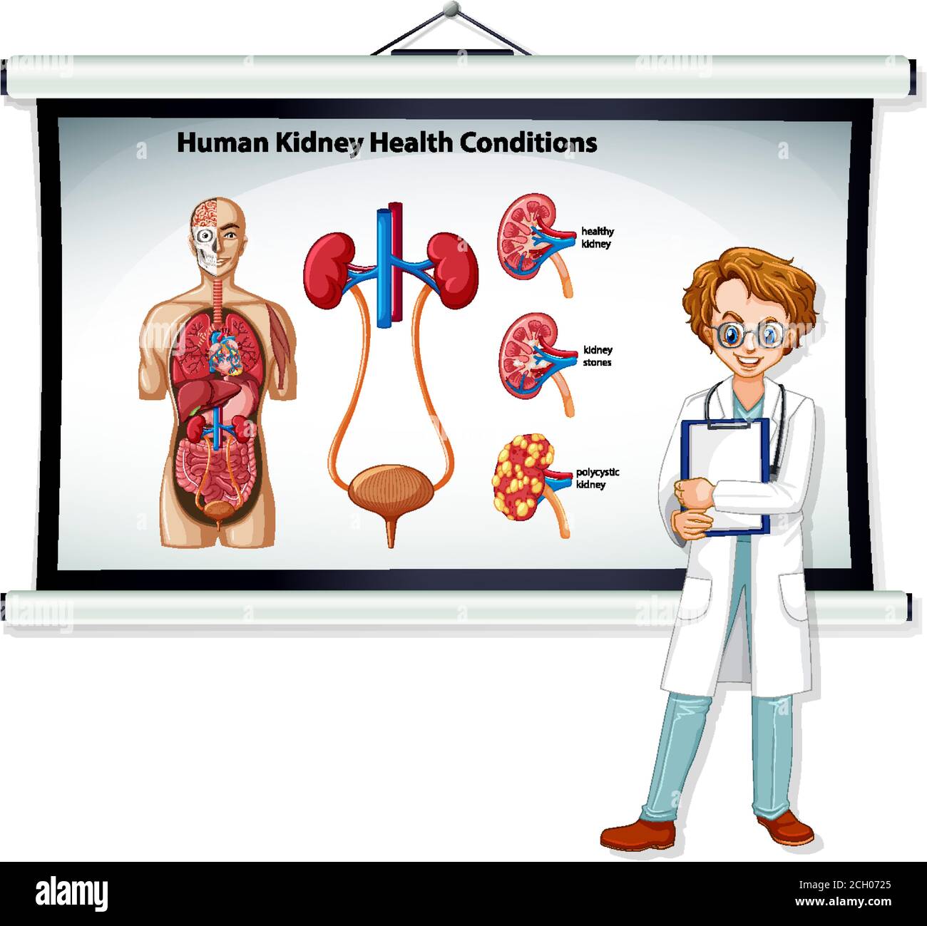 Human Kidney Health Conditions Infographic with doctor cartoon ...
