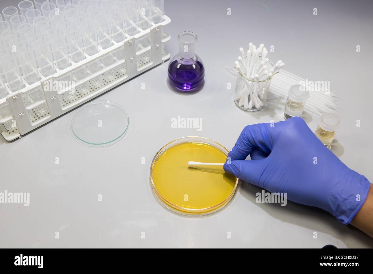 Samples of bacteria hi-res stock photography and images - Alamy