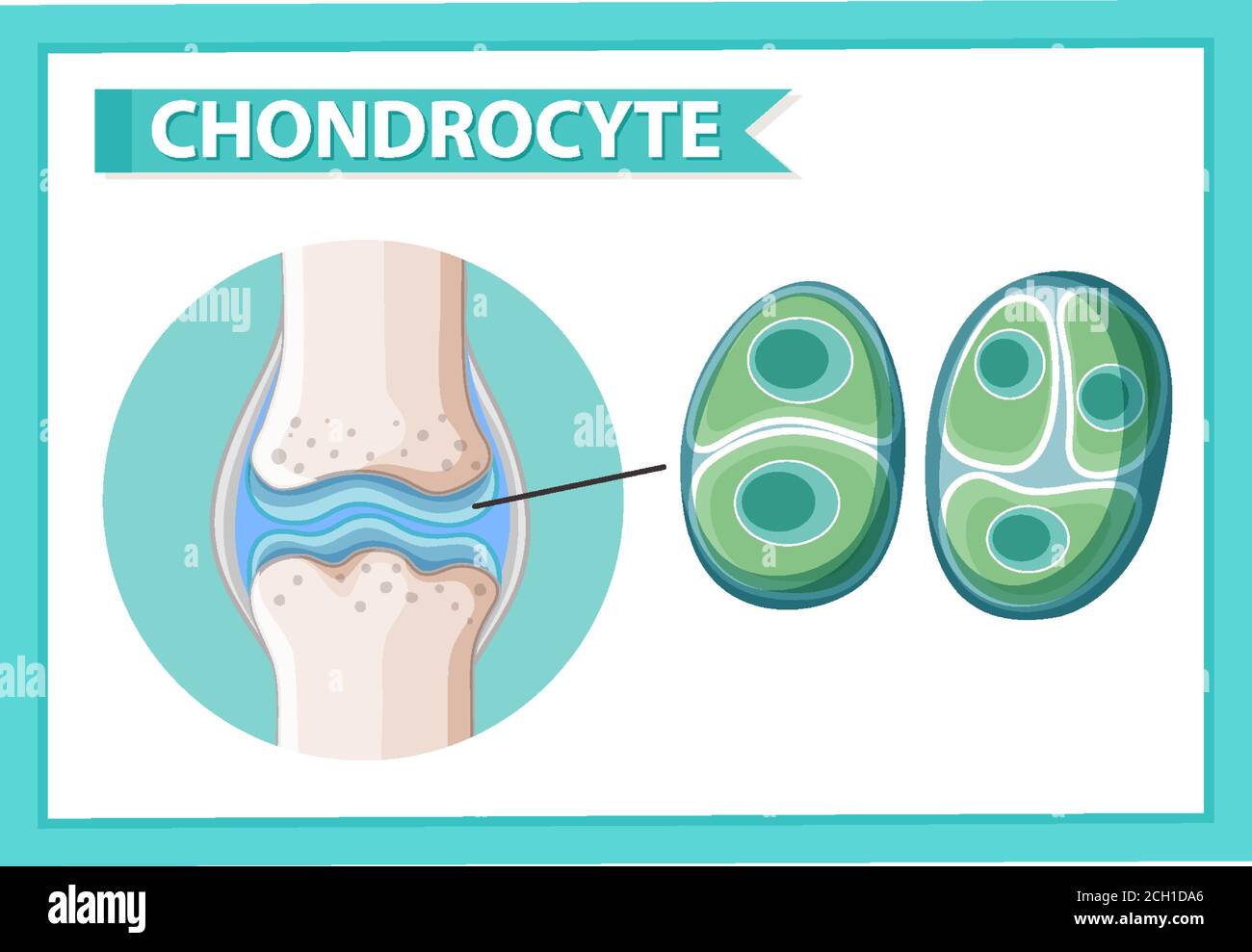 Informative poster of chondrocyte illustration Stock Vector Image & Art ...