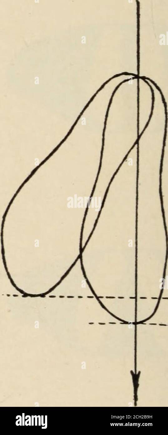 . The Hahnemannian monthly . Fig. III. Fig. III. Left—Foot as a lever ...