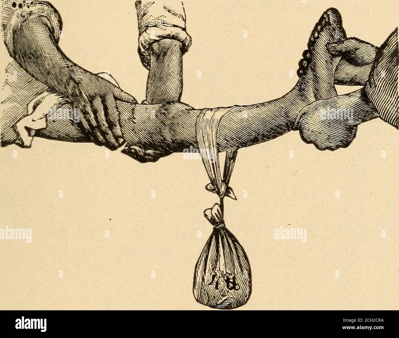 Bow fracture hi-res stock photography and images - Alamy