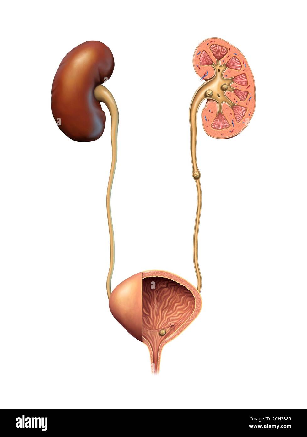 Kidney and urinary stones formation. Digital illustration Stock Photo ...