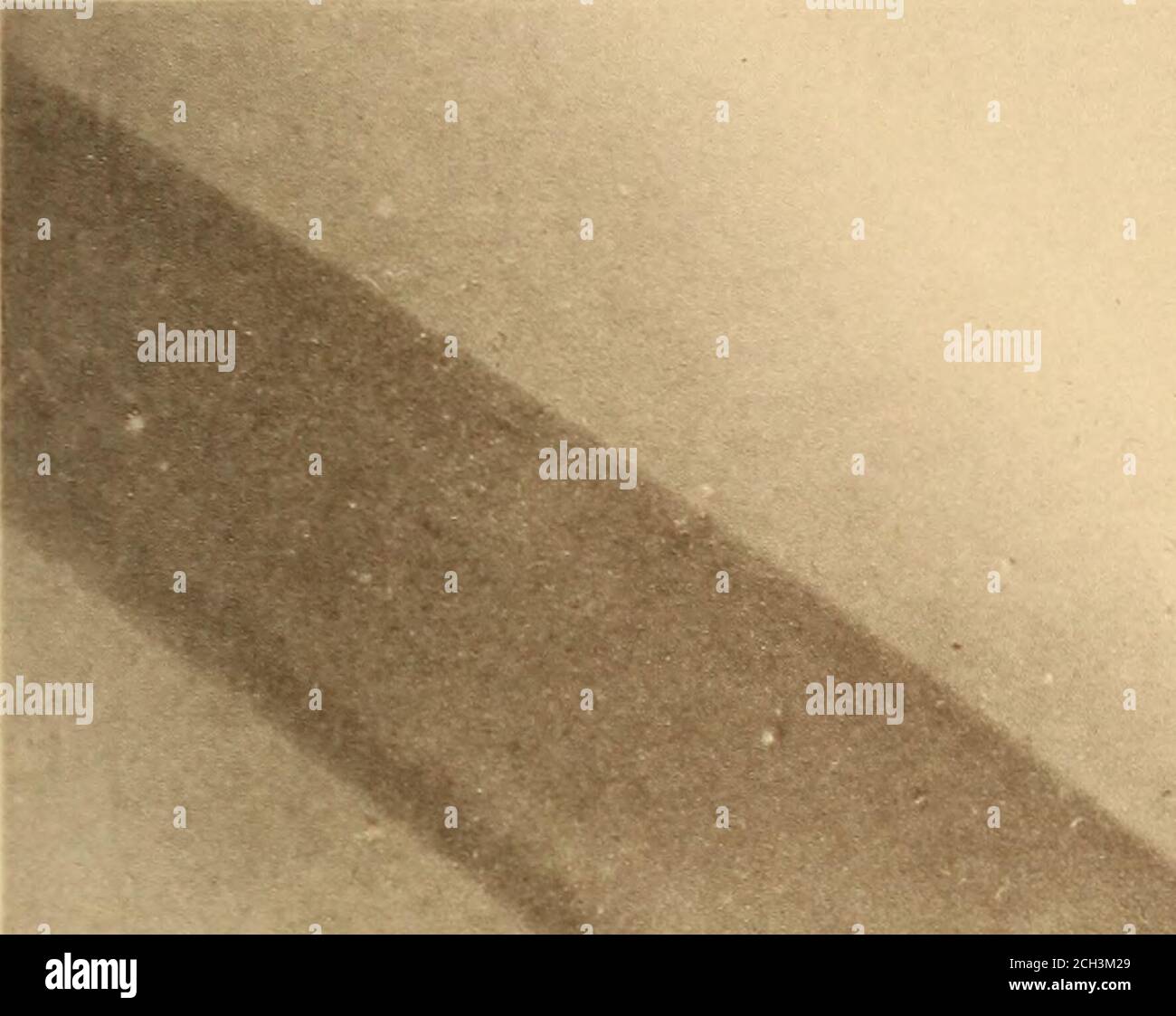 . Atlas and epitome of traumatic . Condylus media/is fmwrts ...