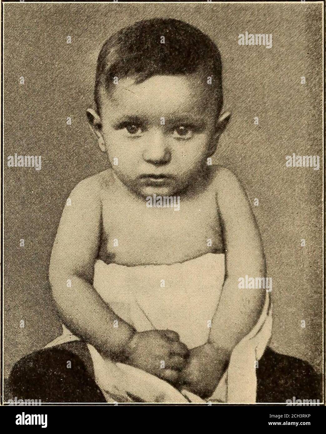 Sternomastoid hi-res stock photography and images - Alamy