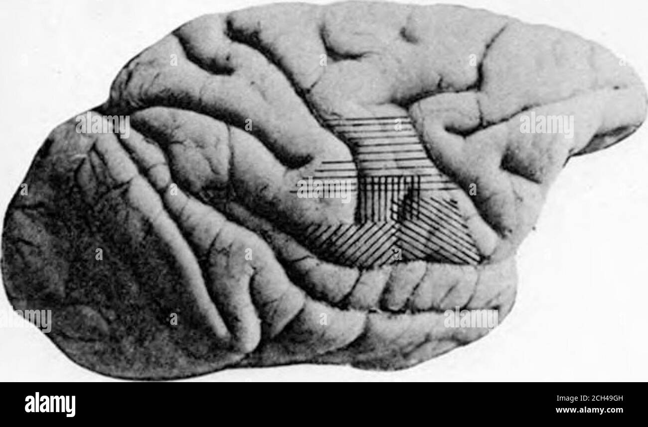 . A Further Minute Analysis by Electric Stimulation of the So-Called ...