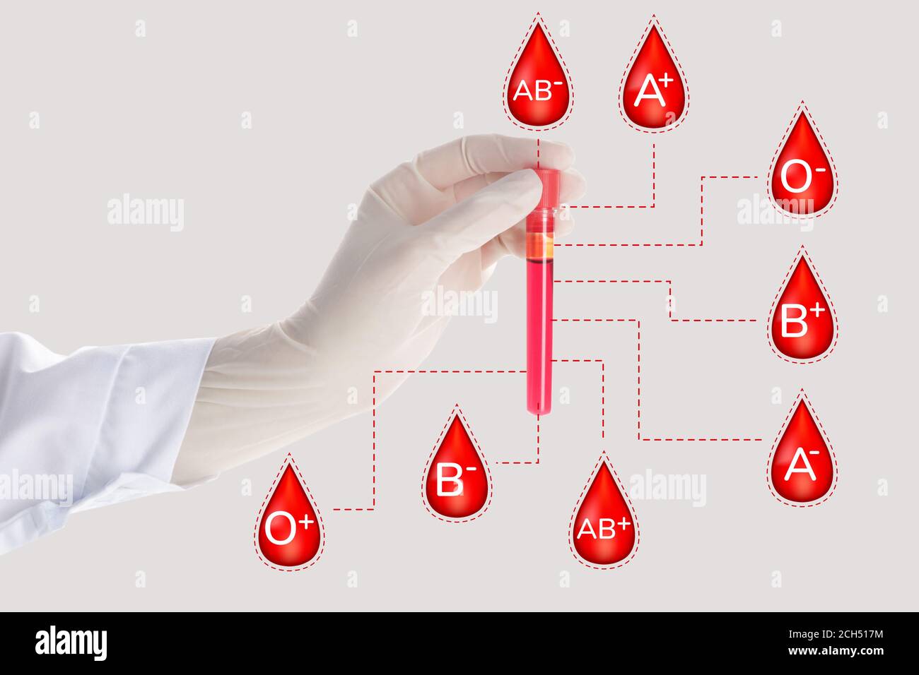 Tube with sample in doctor's hand on light background. Determination of ...