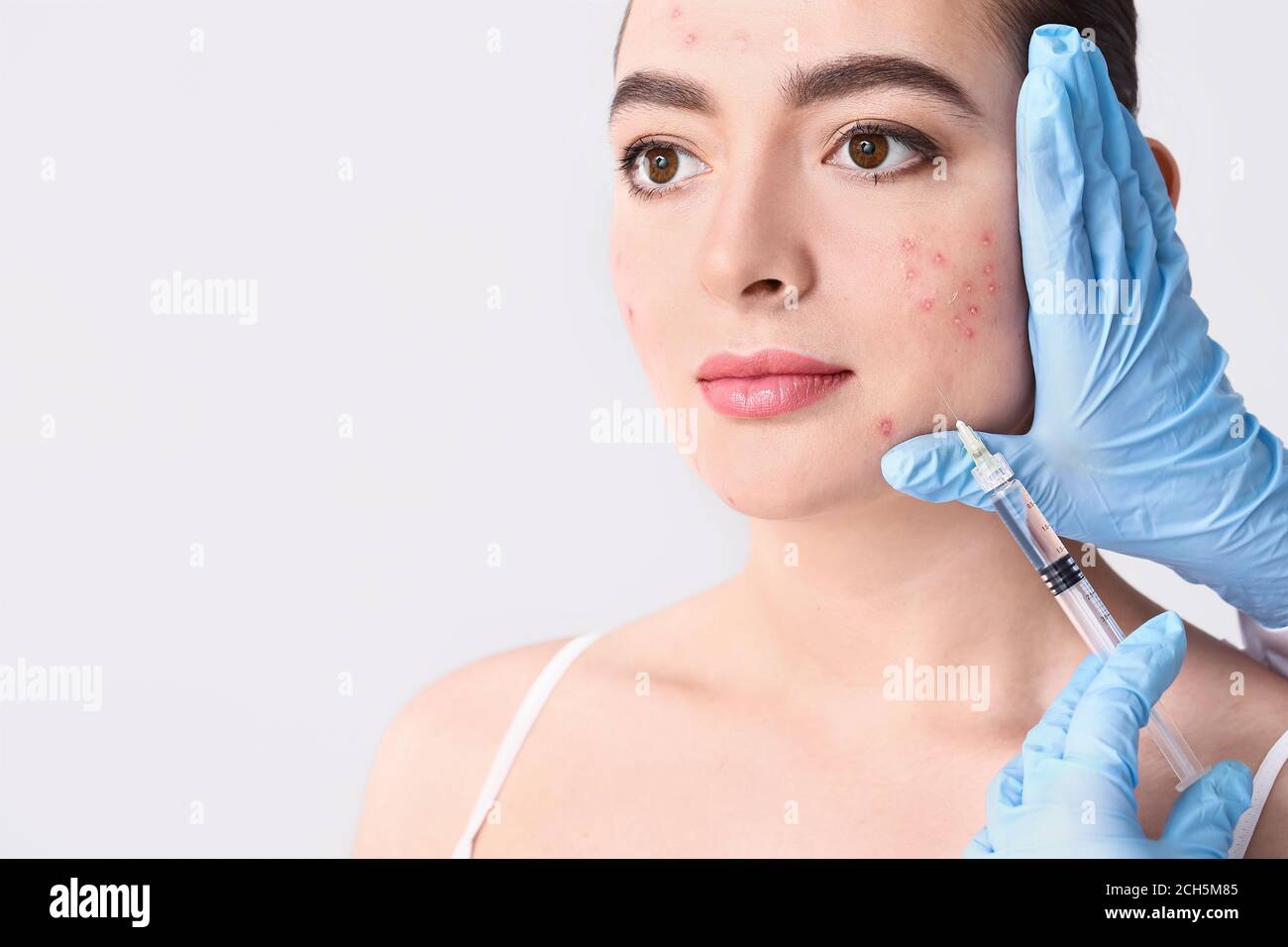 Young woman with acne problem receiving injection in her face against ...