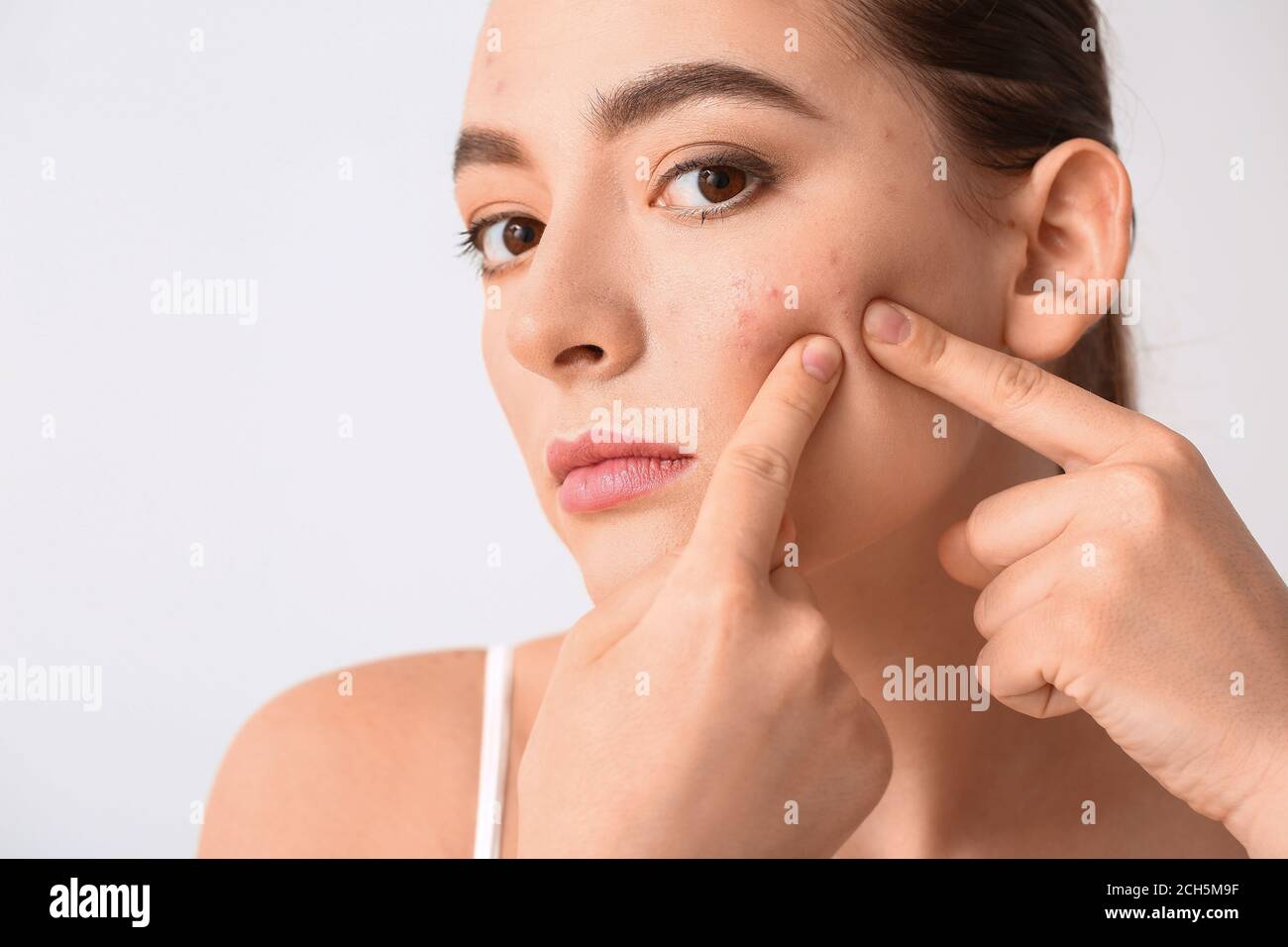 Young woman with acne problem squishing pimples on white background ...