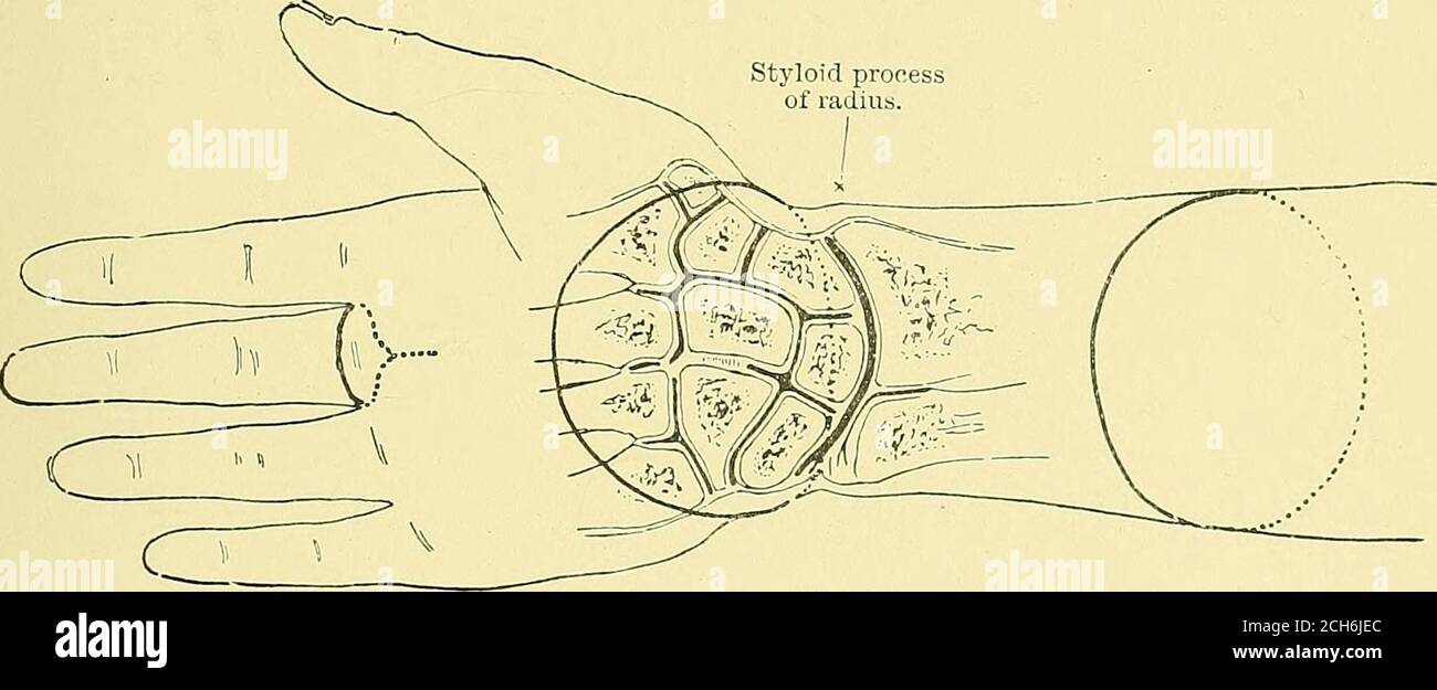 . Text-book of operative surgery . incision is made, the upper end of ...