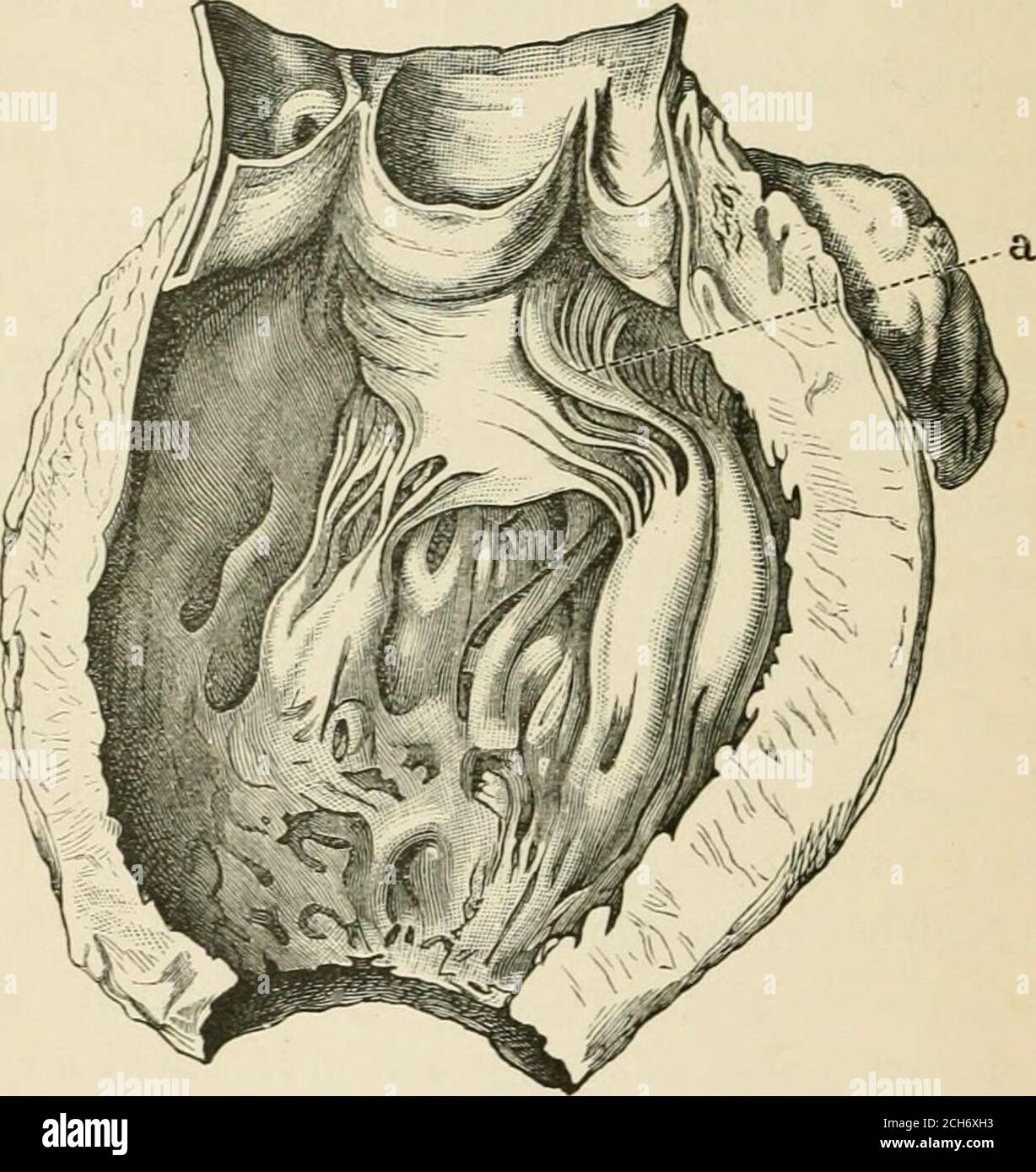 . Evolution and disease . of the vertebrae. In manyinstances, when a ...