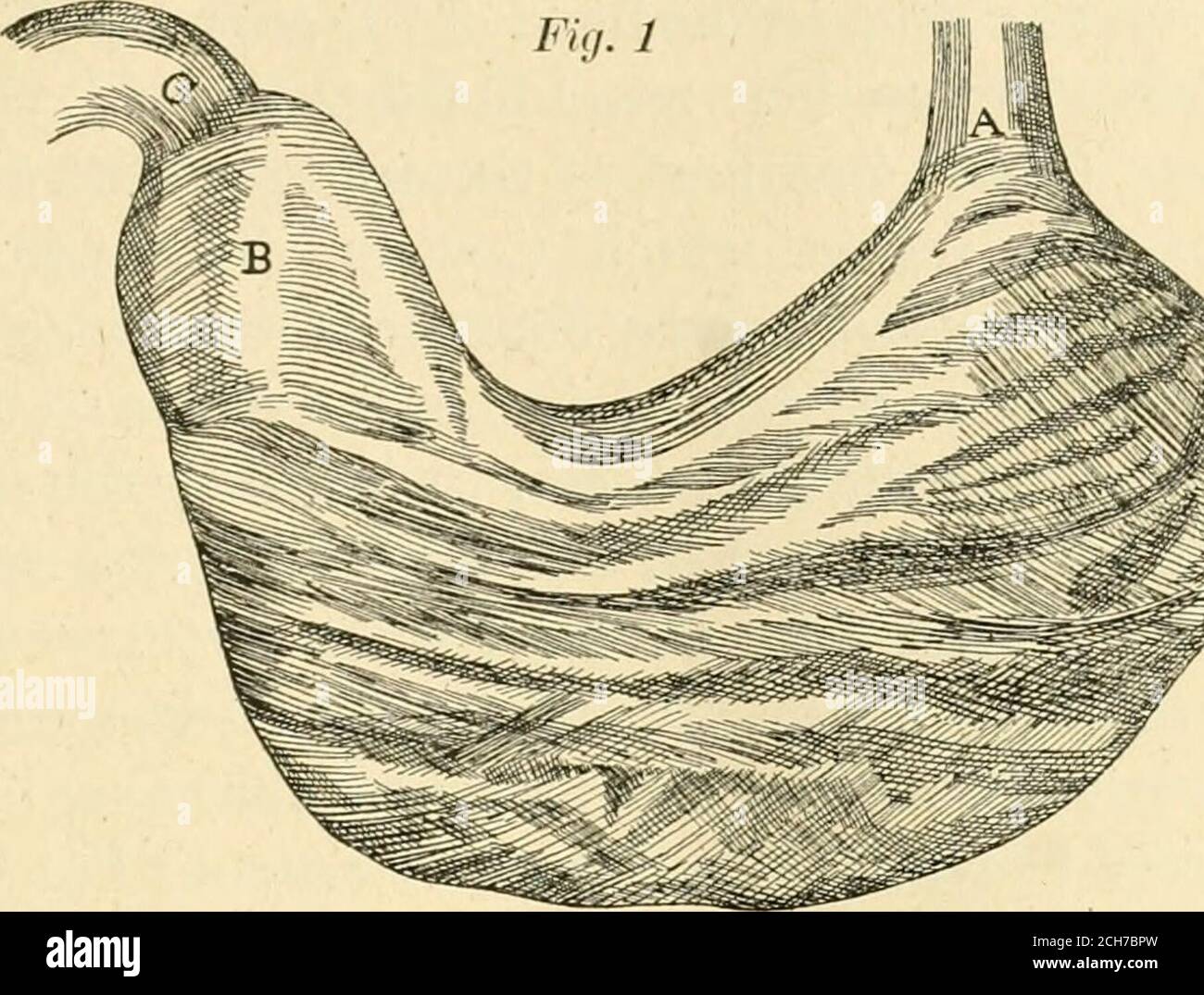 Antrum pylori hi-res stock photography and images - Alamy
