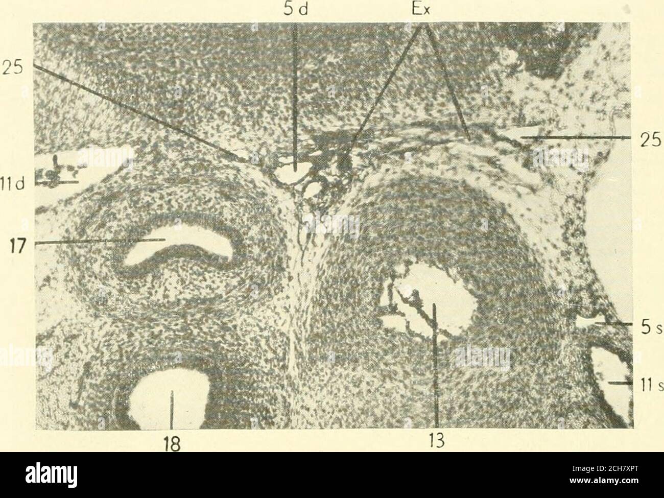 Aorta Slide Labeled