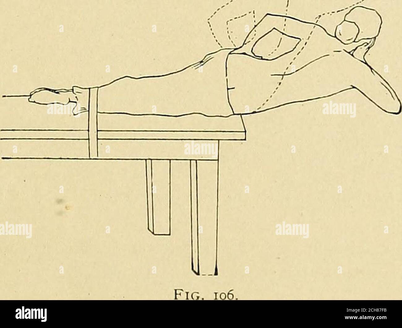 Laterally supported hi-res stock photography and images - Alamy