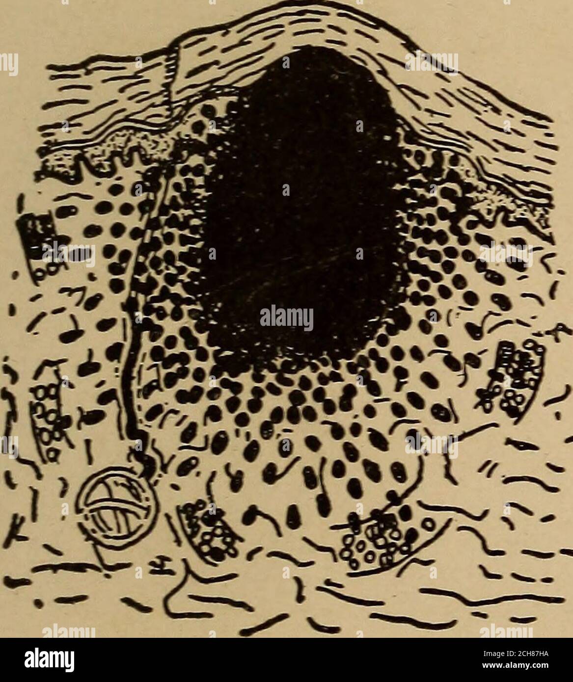 . When to send for the doctor : and what to do before the doctor comes ...