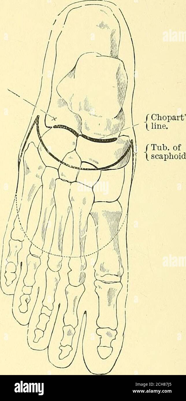 Chopart High Resolution Stock Photography and Images - Alamy