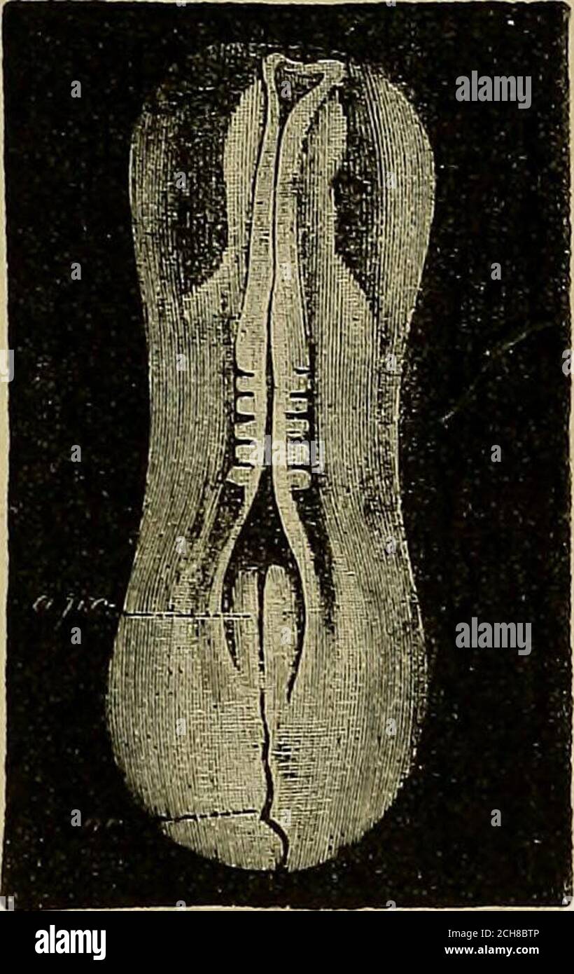 Embryonic sack hi-res stock photography and images - Alamy