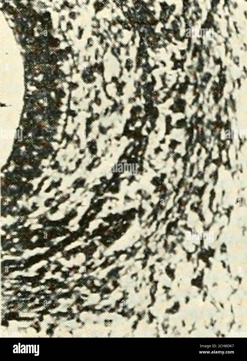 . The American journal of anatomy . JUGULAR LYMPH SAC(INJECTED ...