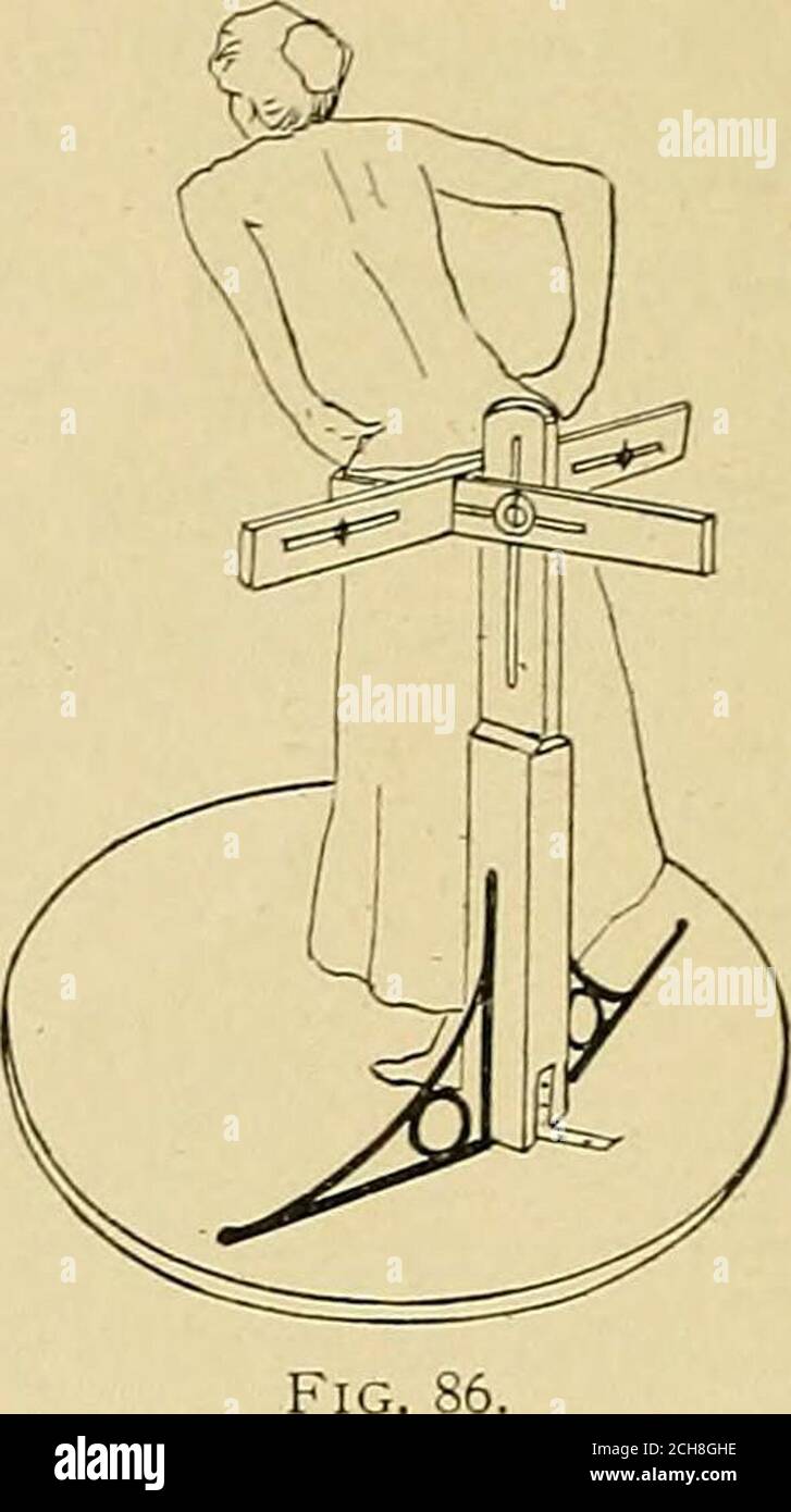. Lateral curvature of the spine and round shoulders . FlG. 85 Stock ...