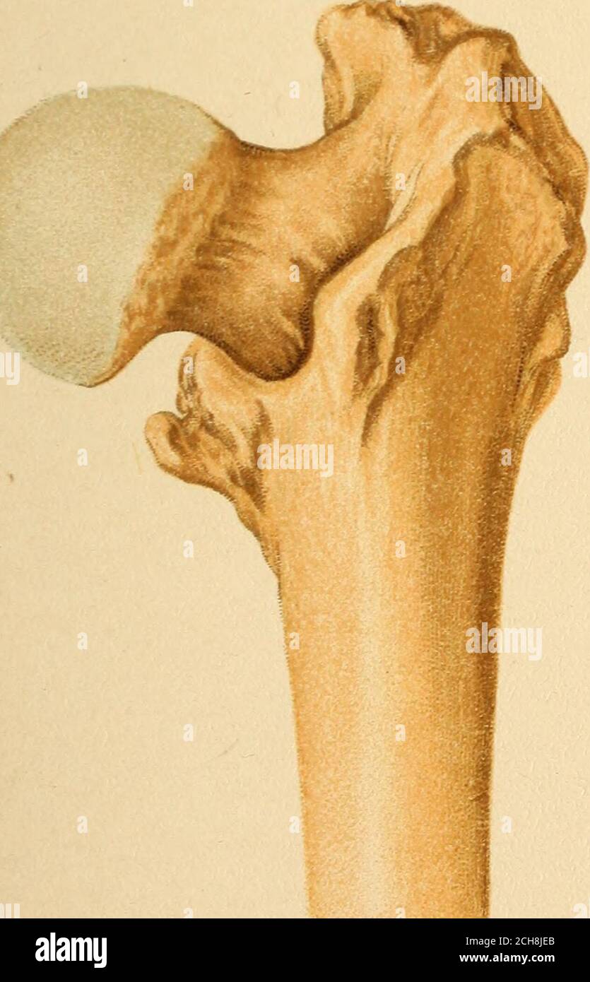 . Atlas and epitome of traumatic . Fig.Si Stock Photo - Alamy