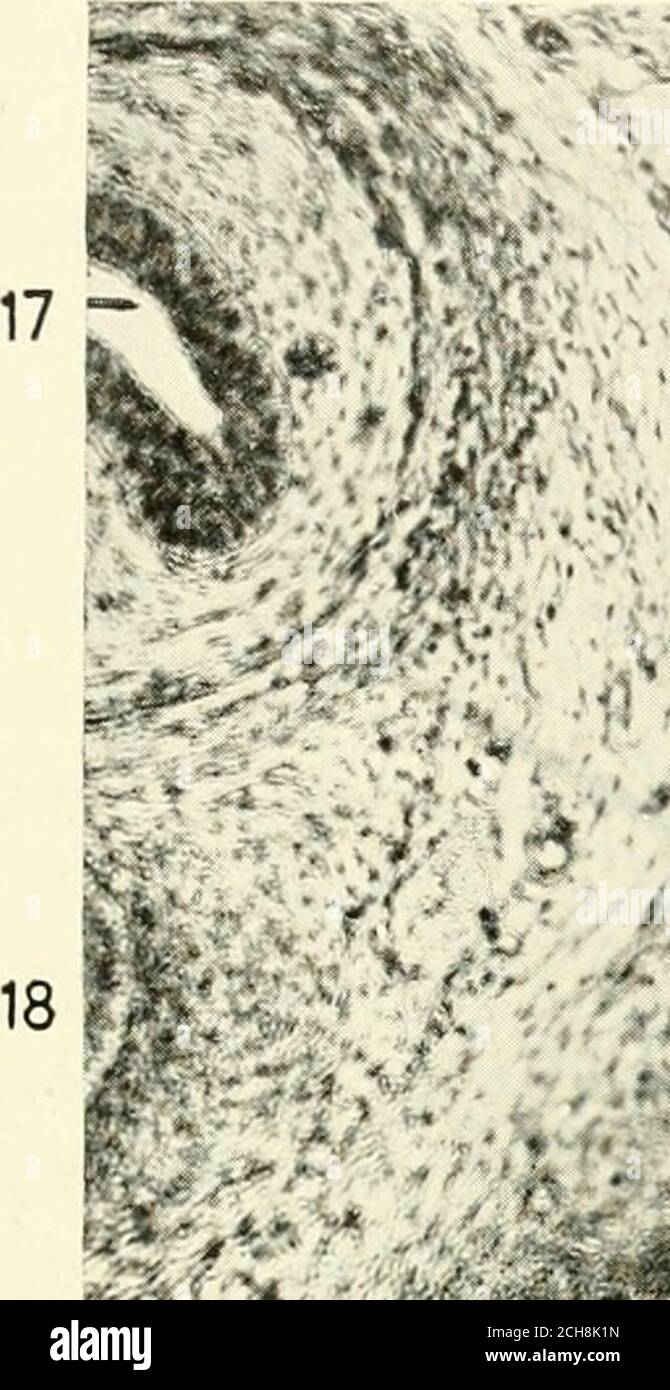 área íntima hi-res stock photography and images - Alamy