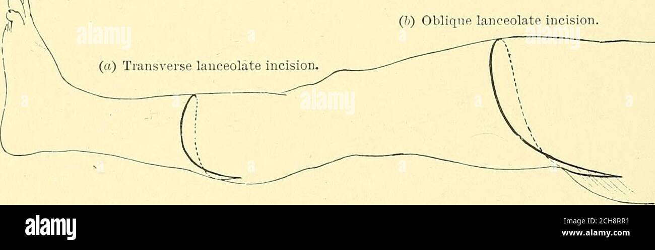 Enforced performing hi-res stock photography and images - Alamy