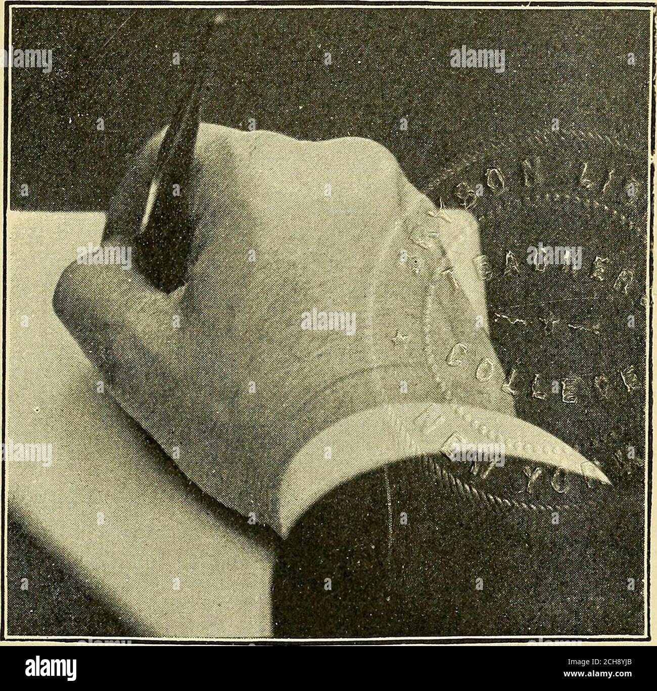 Eye surg hi-res stock photography and images - Alamy