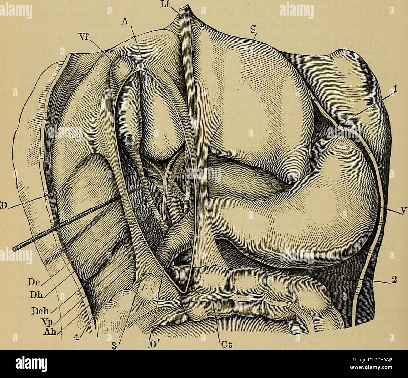 Posterior abdominal wall hi-res stock photography and images - Alamy