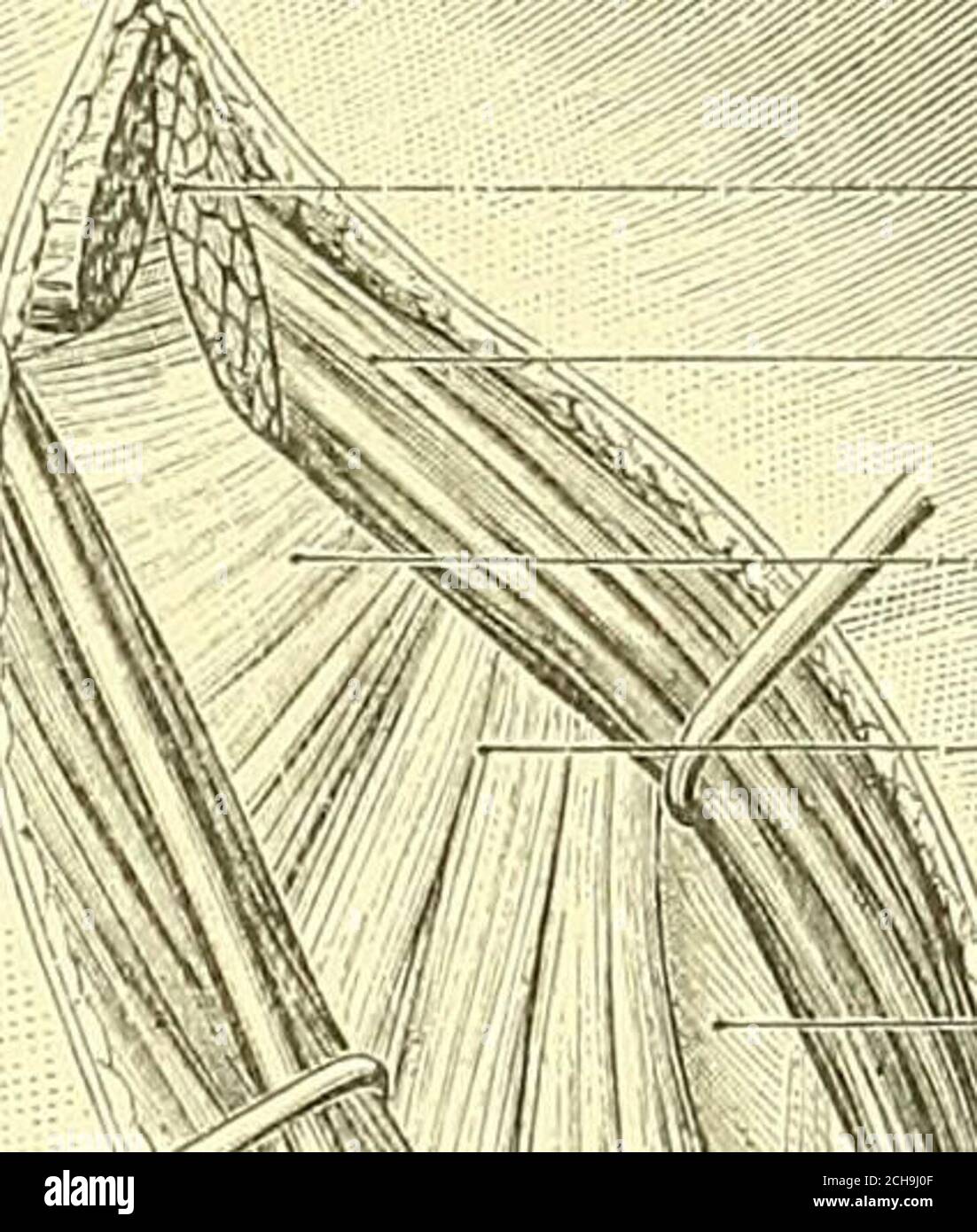 . Text-book of operative surgery . abducted. OPERATIVE SURGERY 34 ...