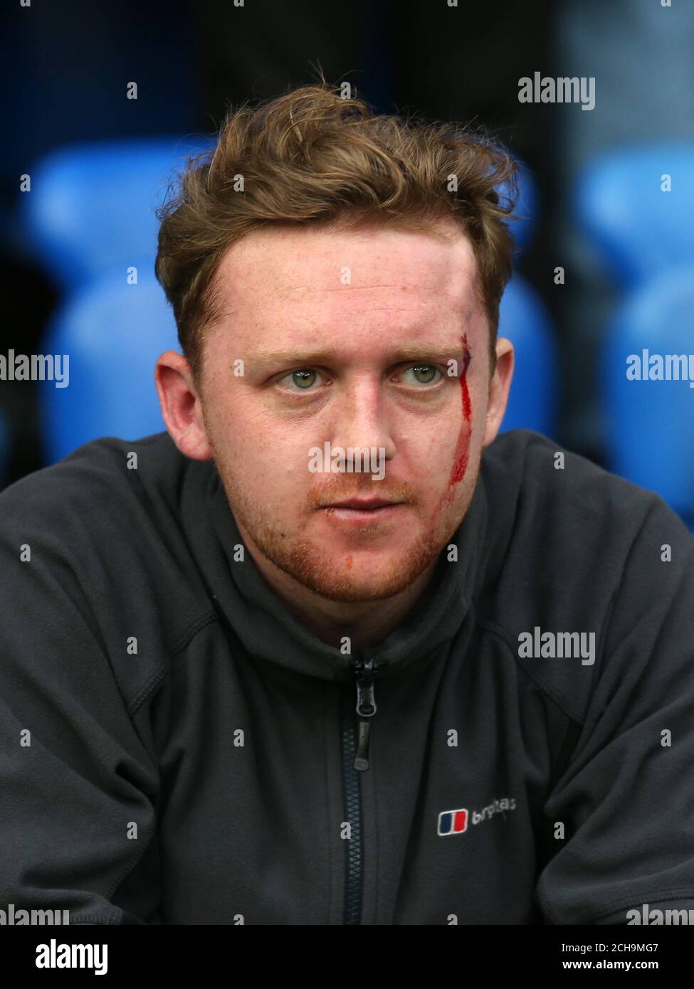 Fan injury hi-res stock photography and images - Alamy