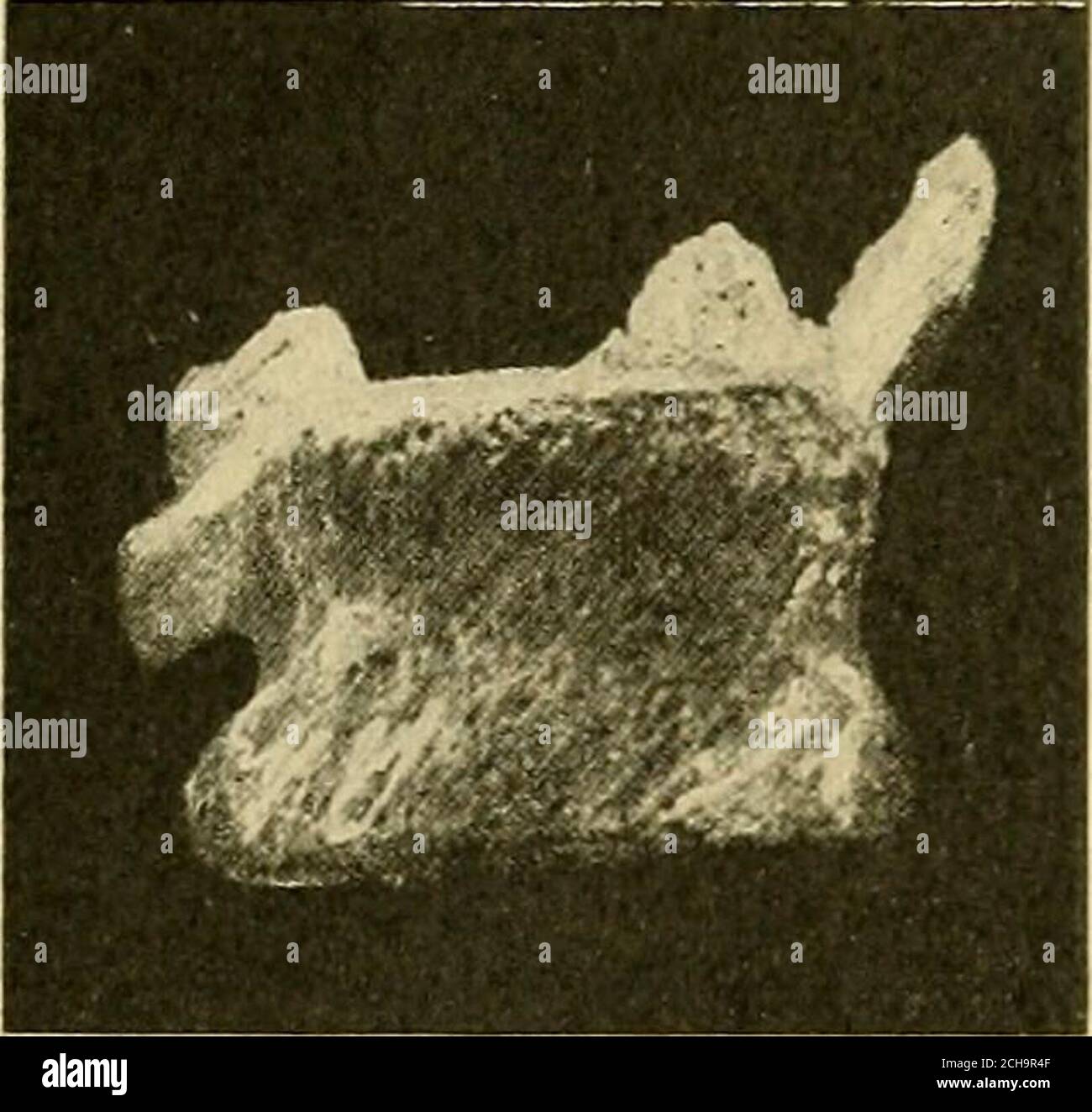 . Lateral curvature of the spine and round shoulders . Fig. 62.—A Wedge ...